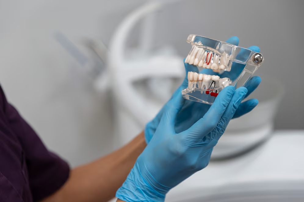 Guide to Dental Implants | Colorado Gum Care